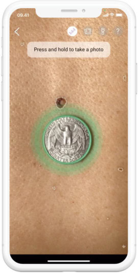 Miiskin: Skin Tracking App and Skin Telehealth Platform