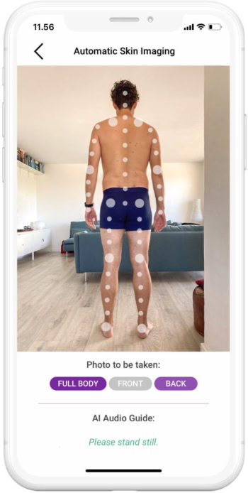 Skin and Mole Checker App | Track Your Skin and Moles