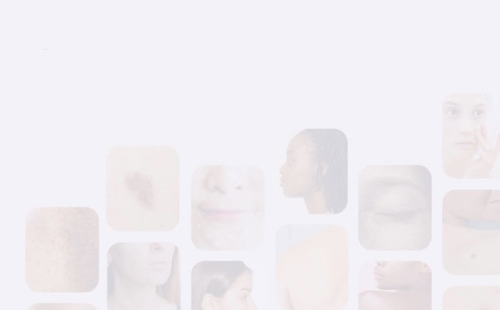 Skin Cancer Signs & Symptoms | The Dermatologist's Essential Guide