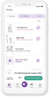 Skin and Mole Checker App | Track Your Skin and Moles