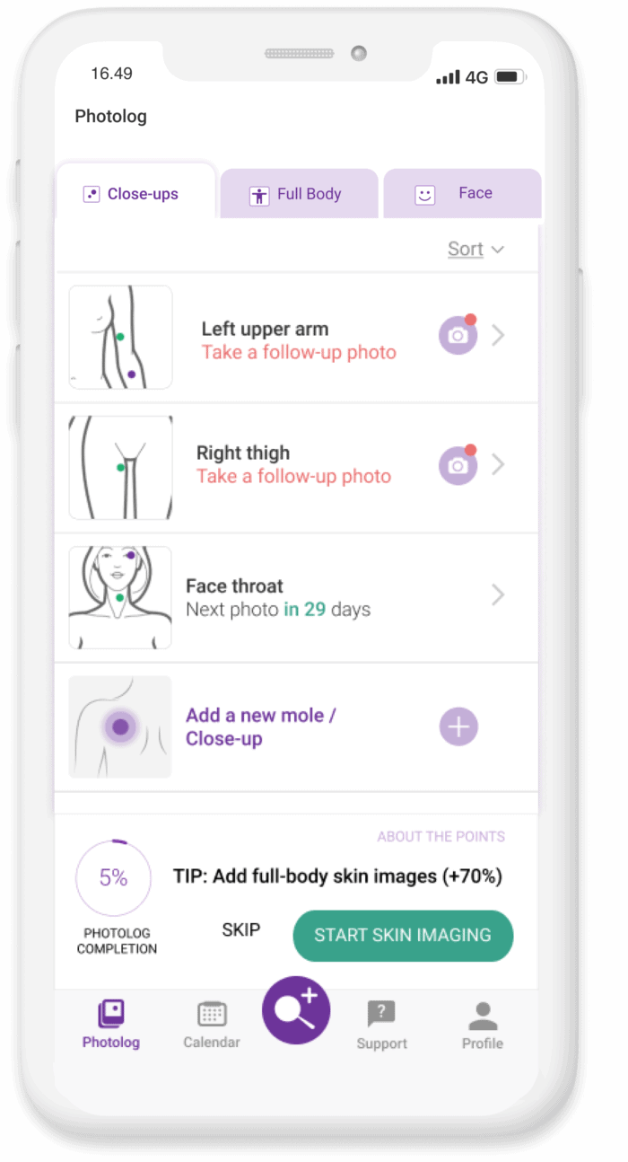Skin and Mole Checker App | Track Your Skin and Moles