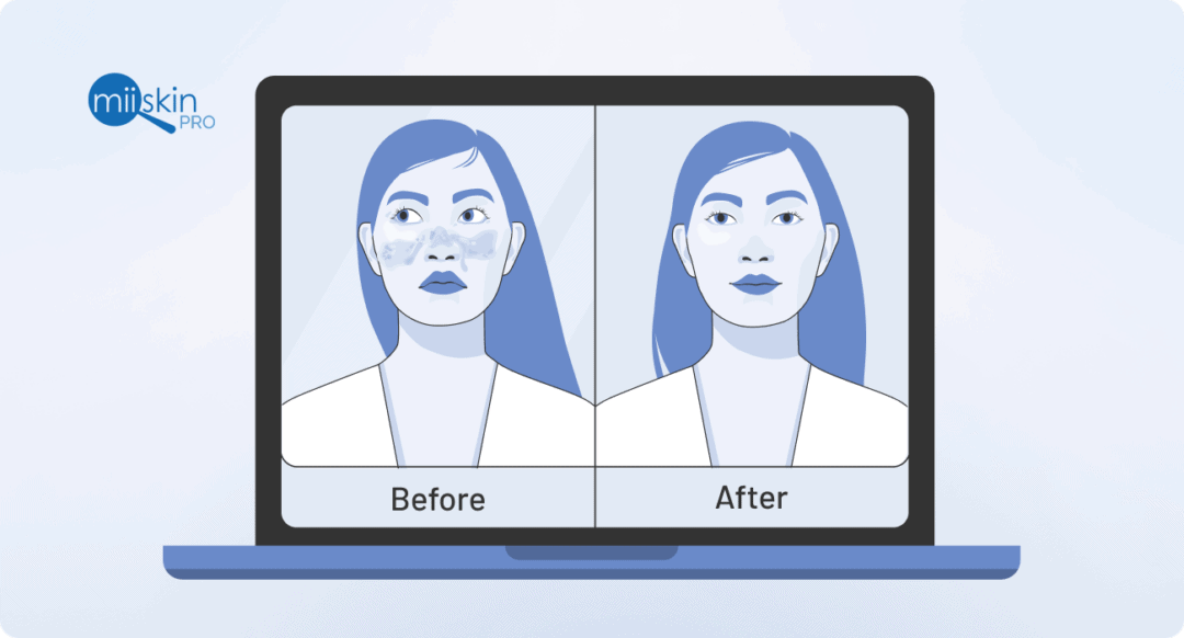 What is Teledermatology? Meaning, Benefits, and Applications