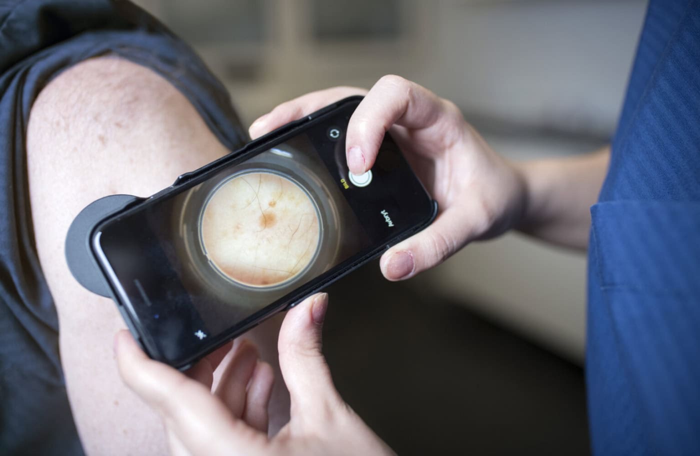 3 teledermatology apps that enable telemedicine in dermatology