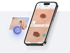 Skin and Mole Checker App | Track Your Skin and Moles