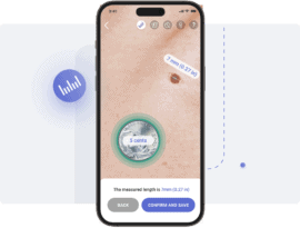 Skin and Mole Checker App | Track Your Skin and Moles