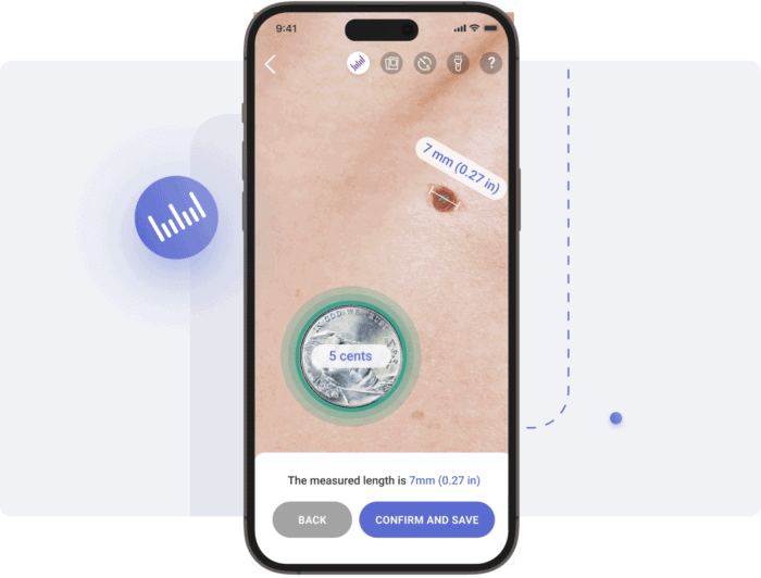 Skin and Mole Checker App | Track Your Skin and Moles