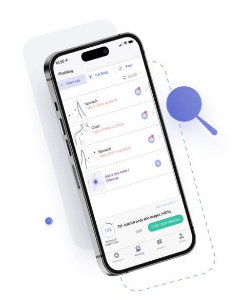 Skin and Mole Checker App | Track Your Skin and Moles