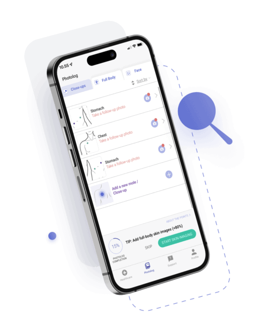 Skin and Mole Checker App | Track Your Skin and Moles