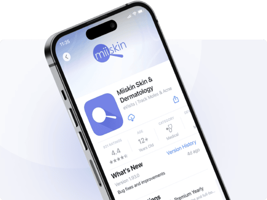 Topical Metronidazole for Rosacea: Benefits and Usage Guide