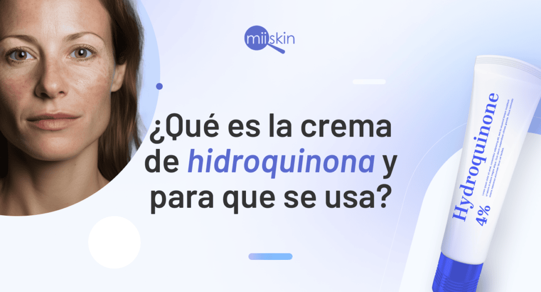 Obtén una crema para el melasma | Consulta 499 pesos