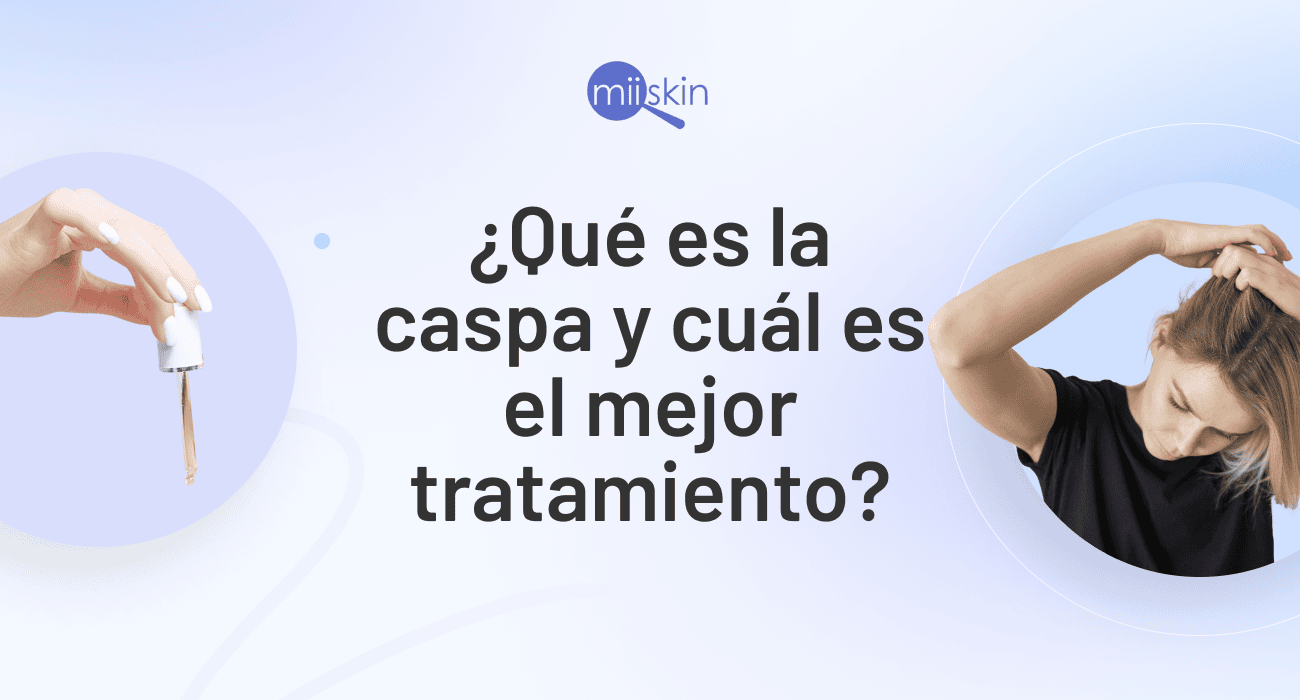 Guía dermatológica: Los mejores tratamientos para la caspa