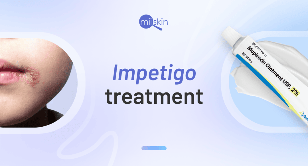 Learn More About Various Skin Diseases and Conditions