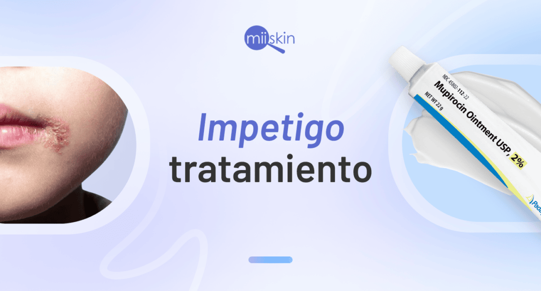 Enfermedades cutáneas