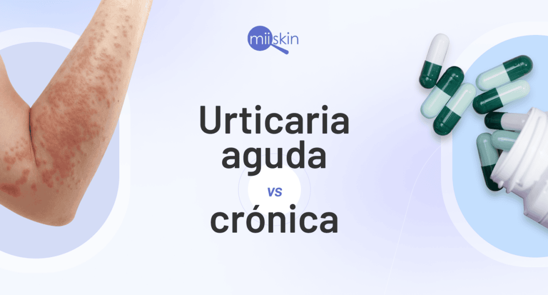 Enfermedades cutáneas