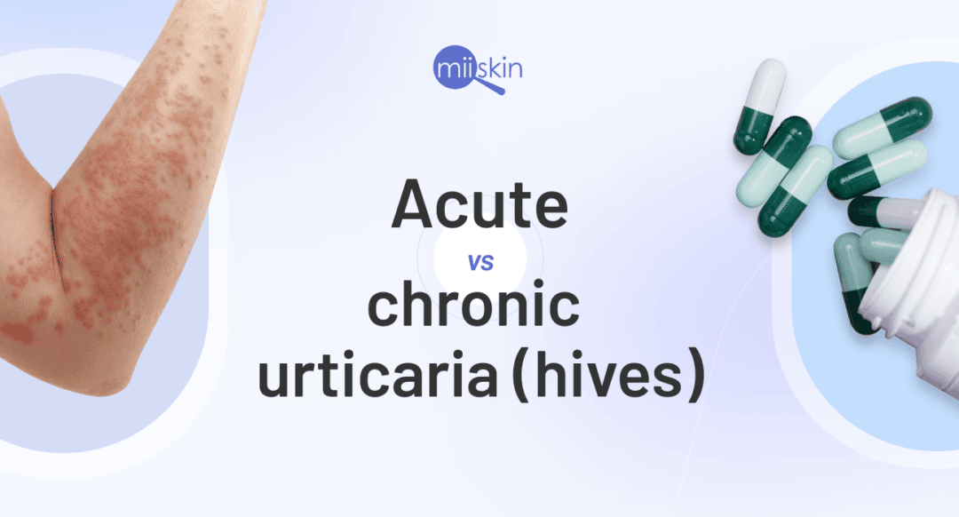 Learn More About Various Skin Diseases and Conditions