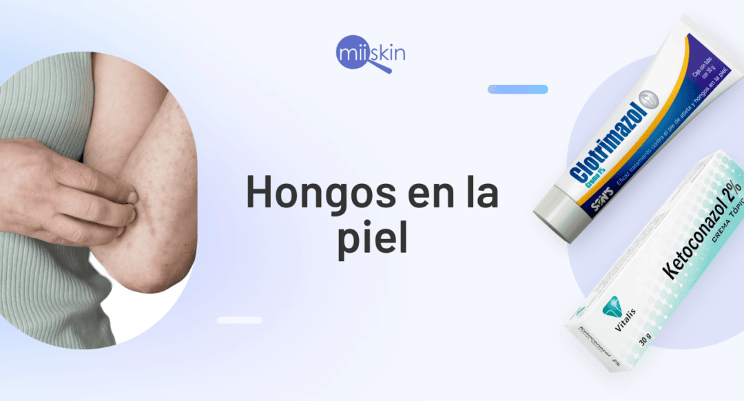 Enfermedades cutáneas