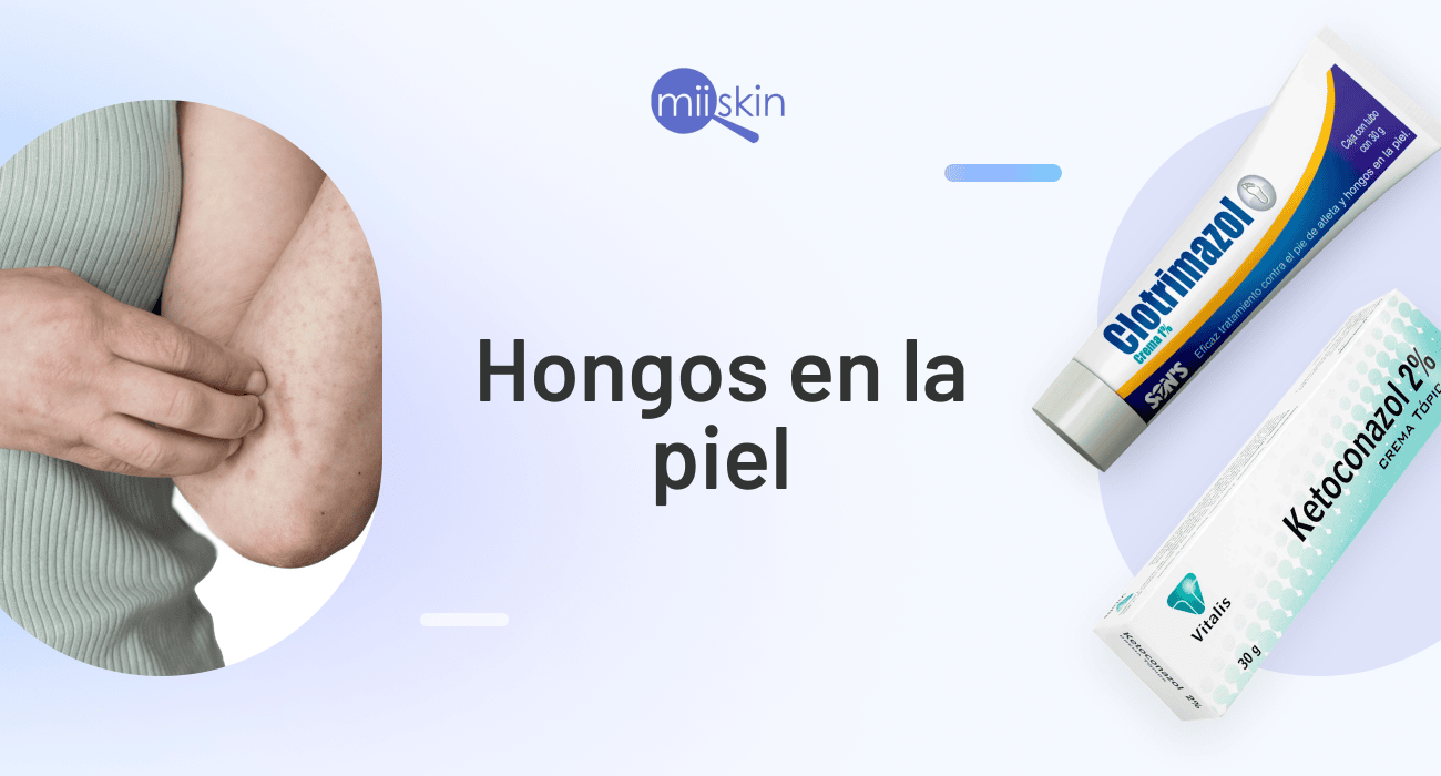 Enfermedades cutáneas