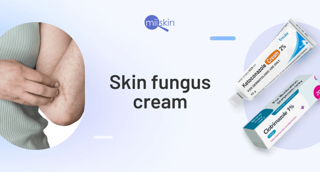 Anti-fungal cream prescription by dermatologist