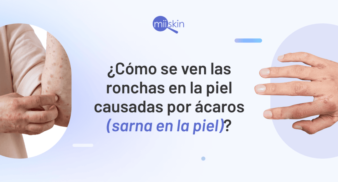 Enfermedades cutáneas