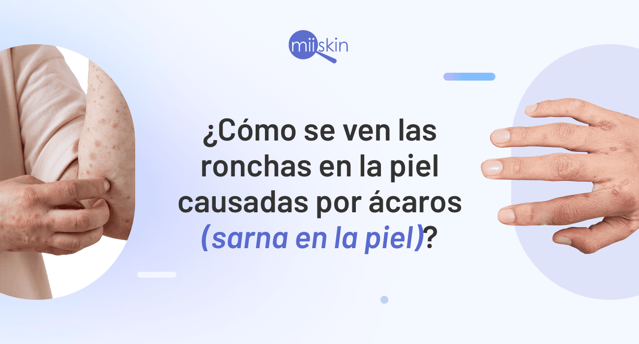 Enfermedades cutáneas