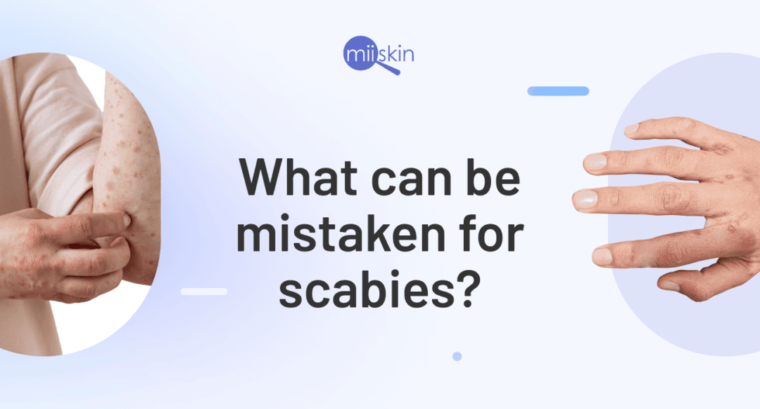 Learn More About Various Skin Diseases and Conditions