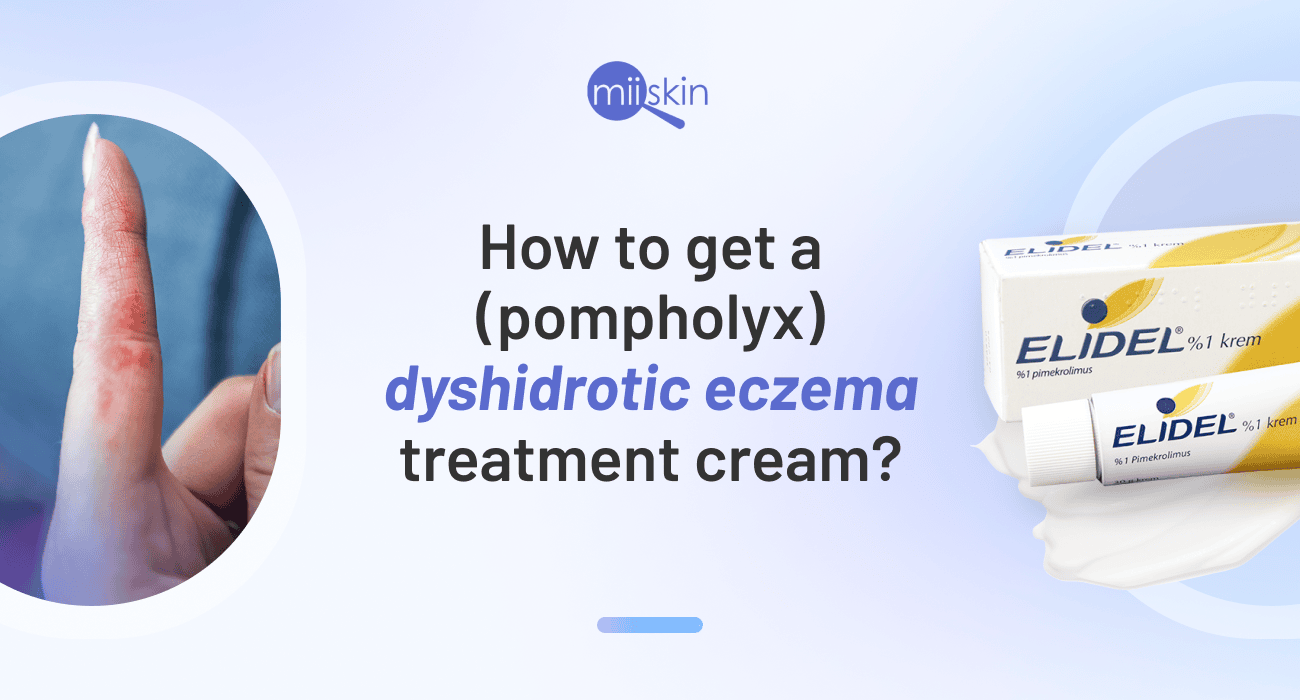 Dyshidrotic Eczema Fingers