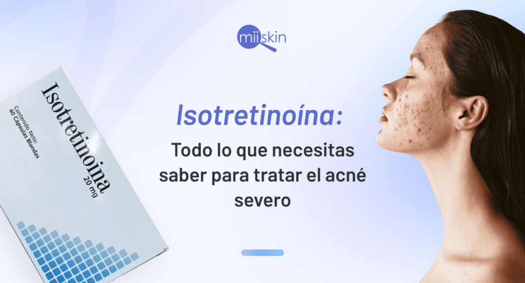 Los medicamentos más comunes para el acné