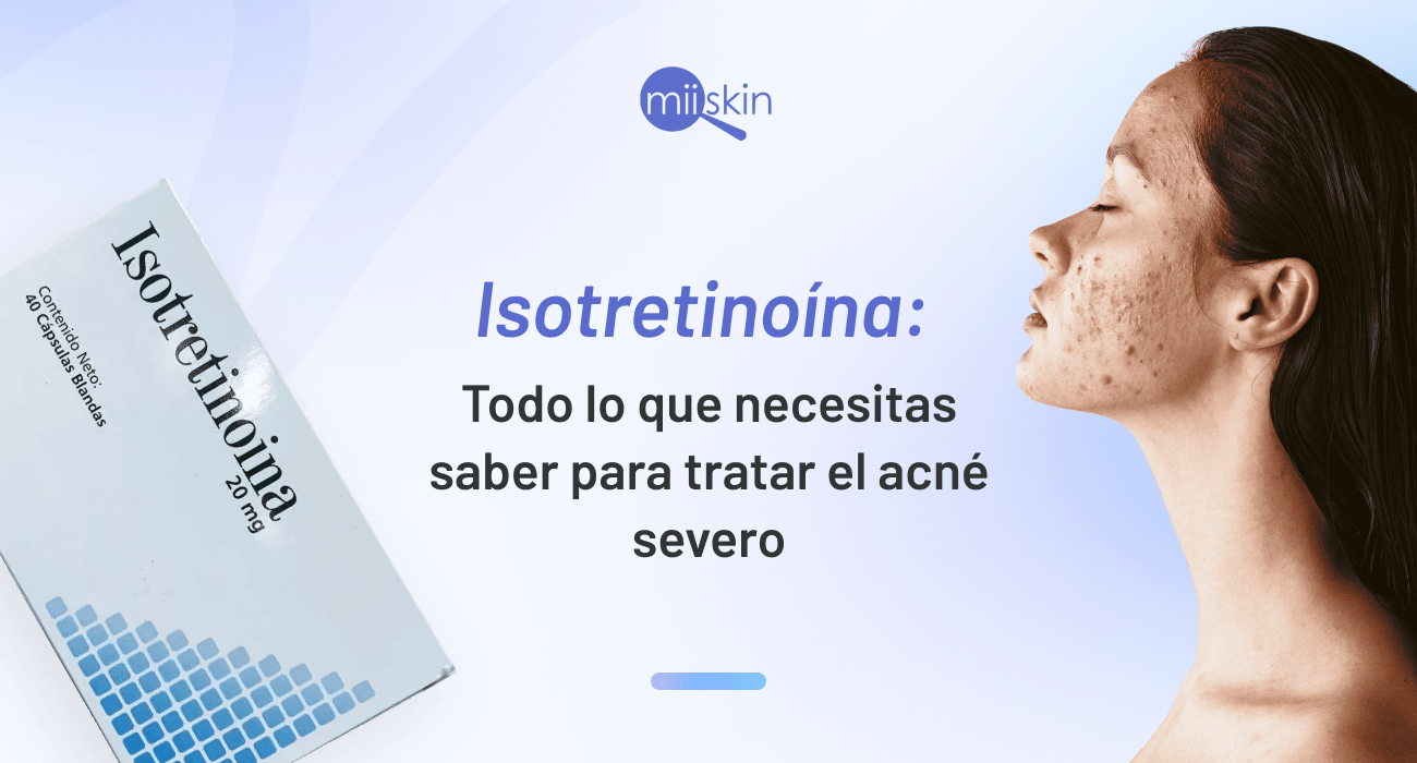 Isotretinoína 10 mg y 20 mg: Uso, Precio y Efectos Secundarios