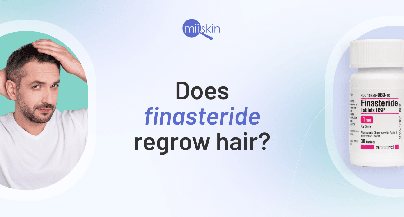 Can finasteride regrow hair?