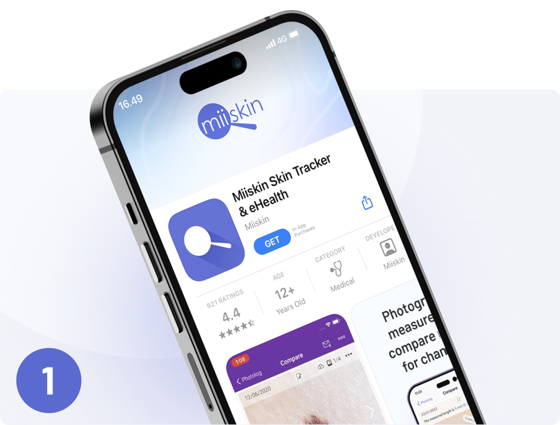 Miiskin App: Connect with Expert Dermatologists