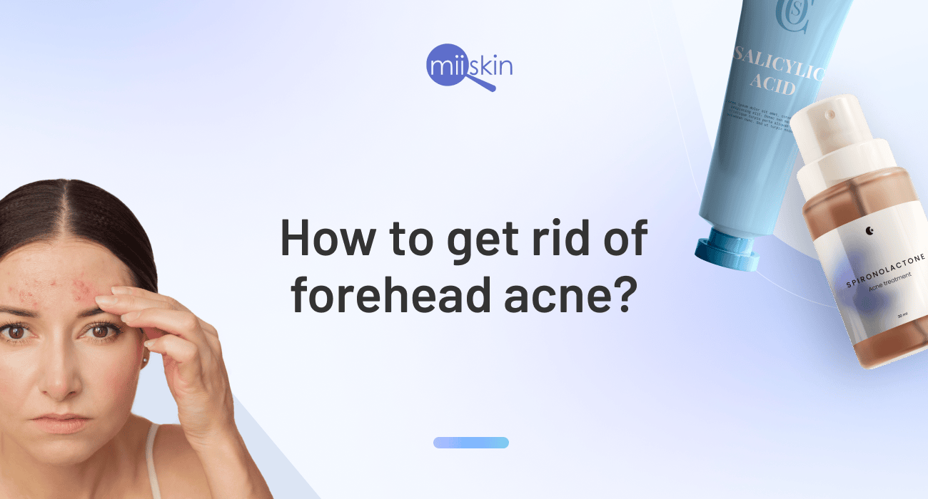 Effective Ways to Treat and Prevent Forehead Acne
