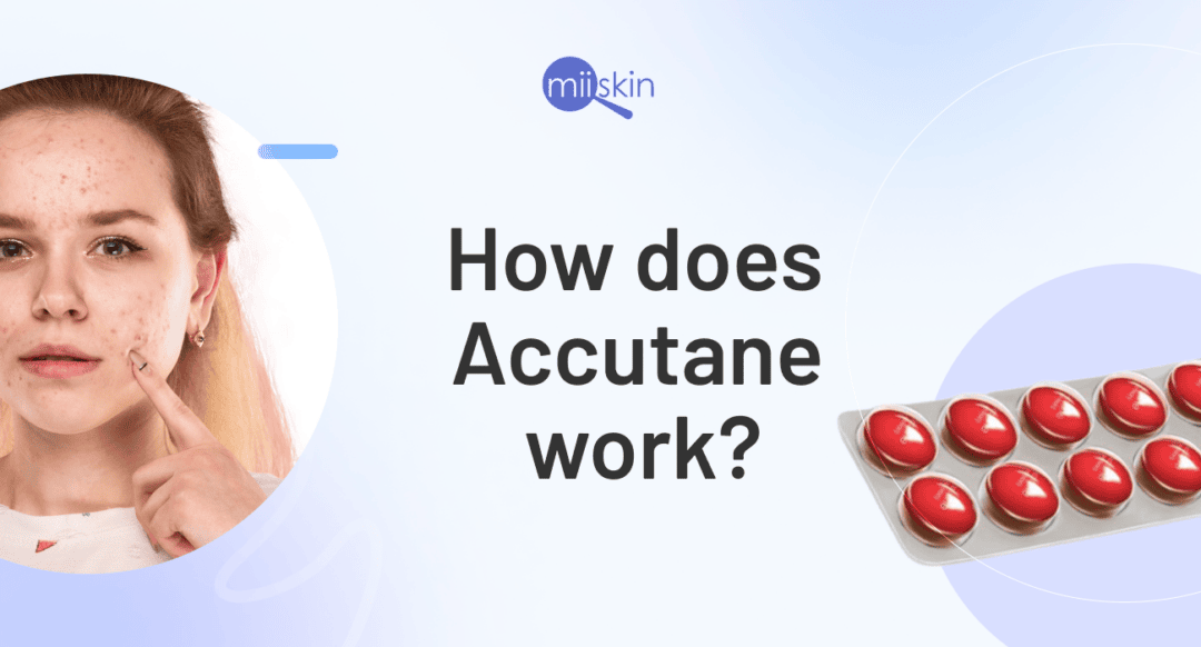 Accutane (isotretinoin): All you need to know