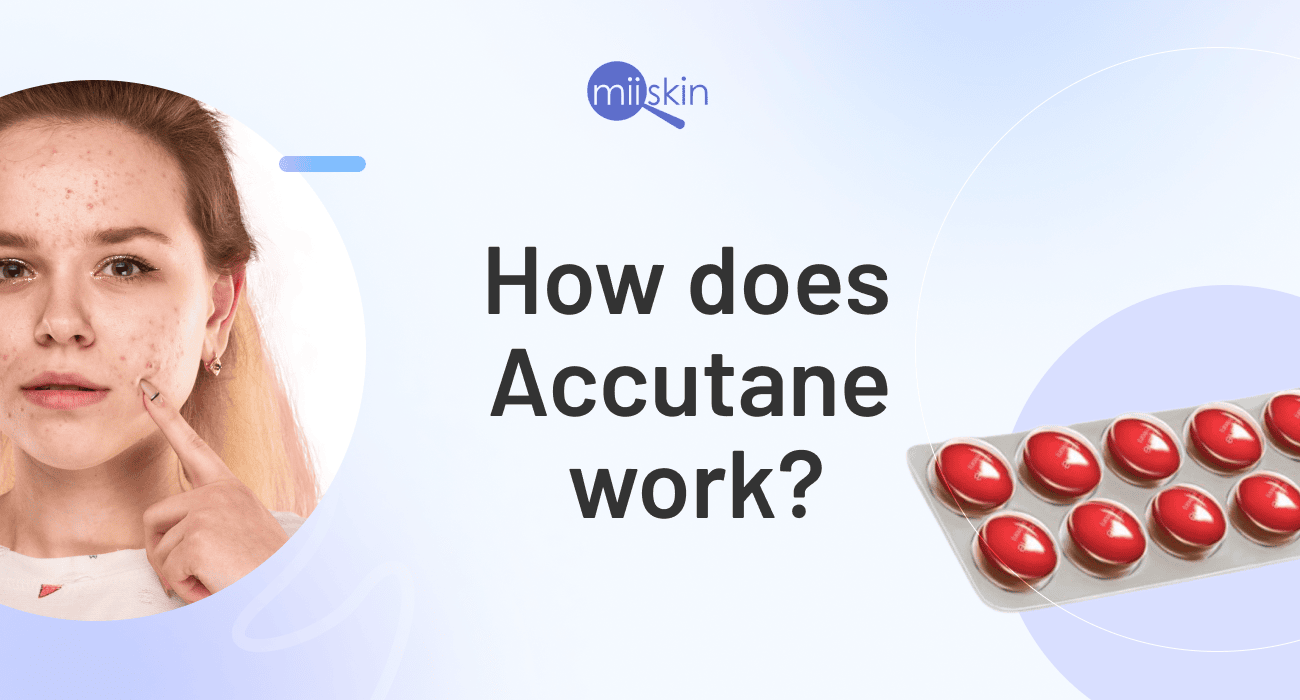 How does Accutane work and how long does it take?
