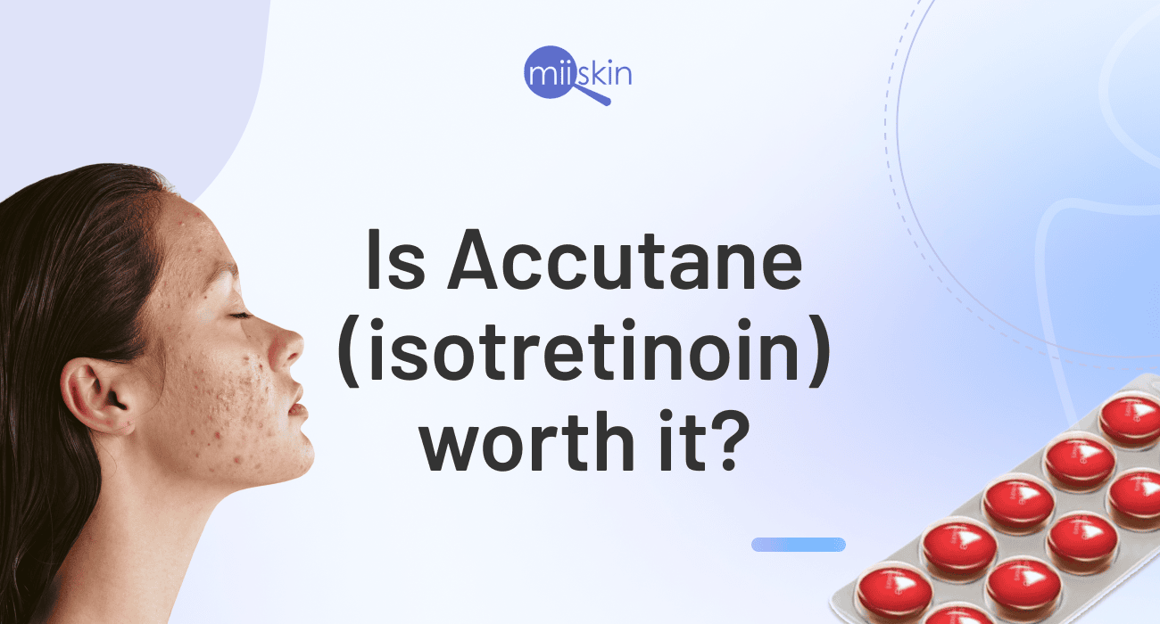 Accutane (isotretinoin): All you need to know