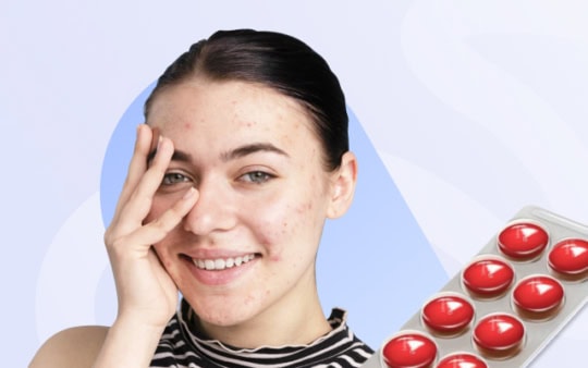 What is the price of Accutane?