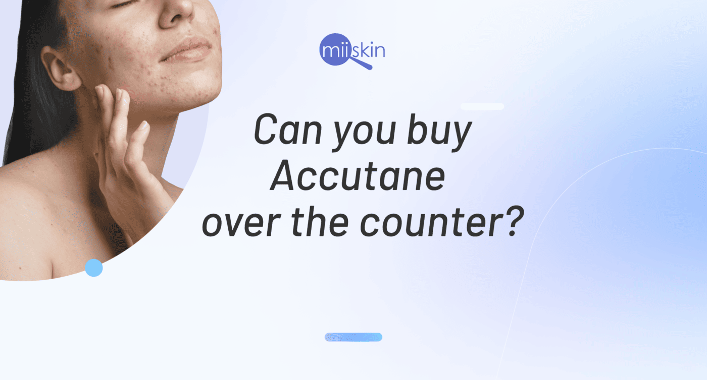 Accutane (isotretinoin): All you need to know