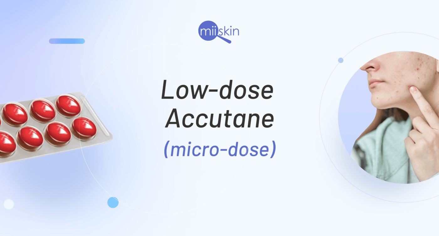 Accutane (isotretinoin): All you need to know