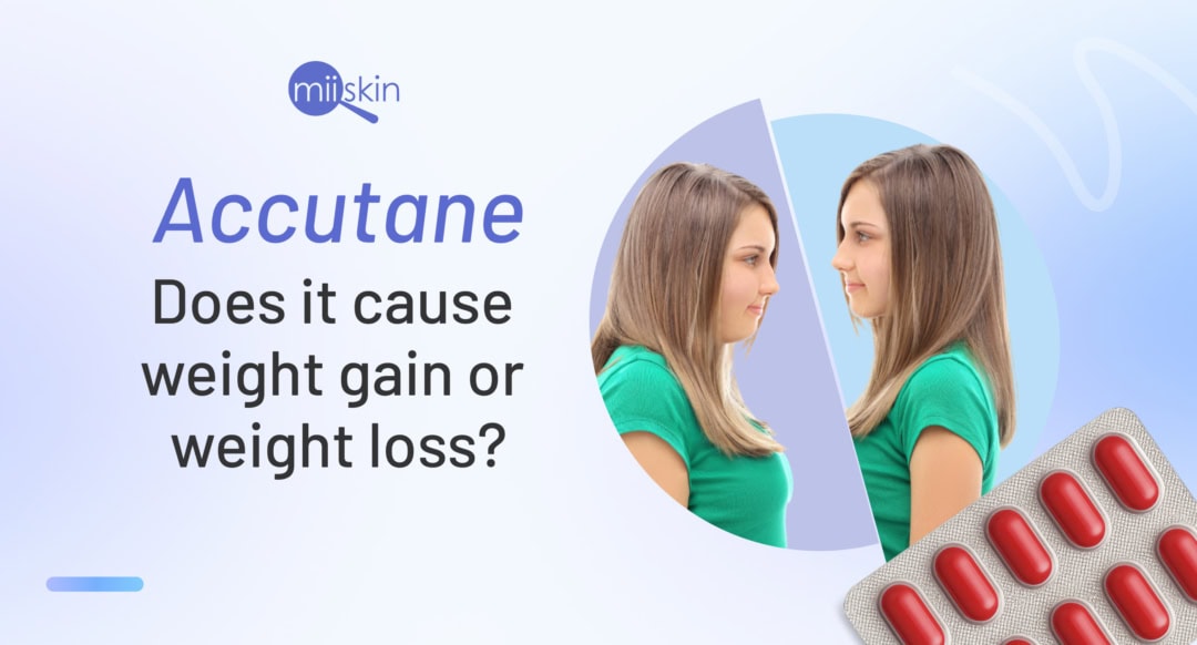 Accutane (isotretinoin): All you need to know
