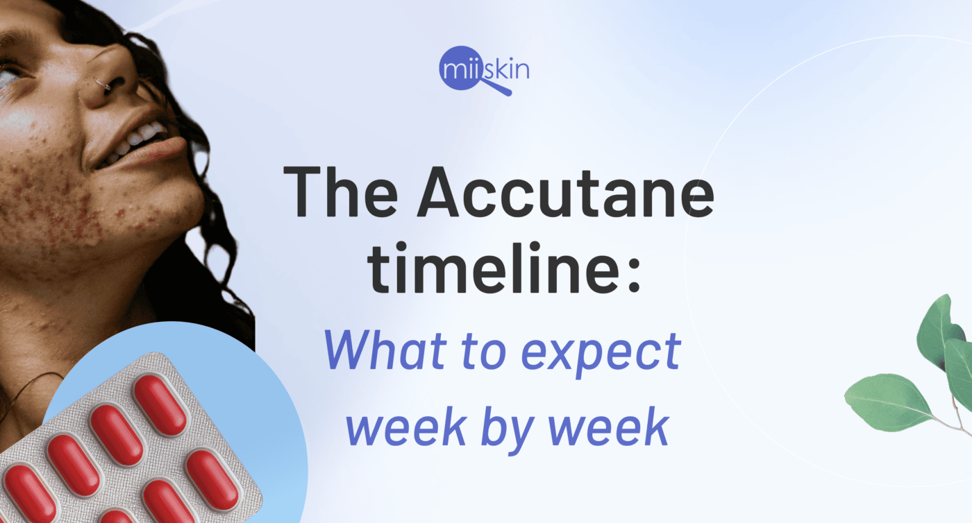 Accutane (isotretinoin): All you need to know