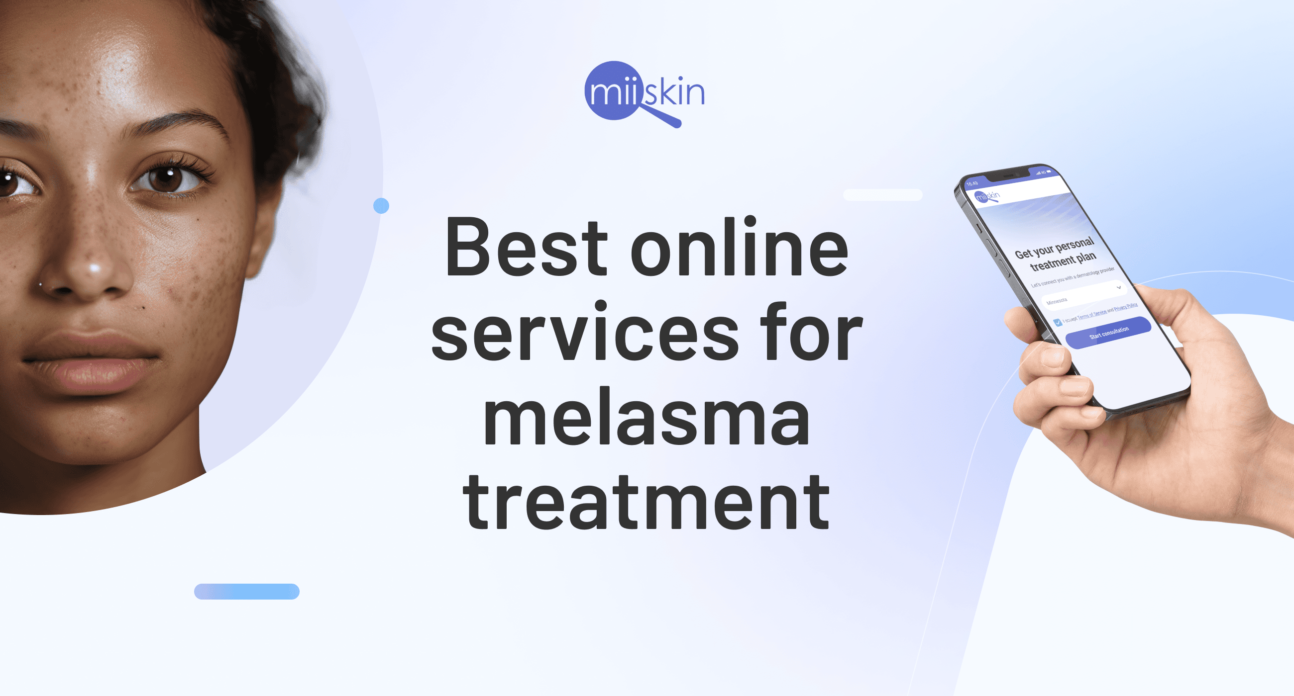 Best online services for treating melasma at home