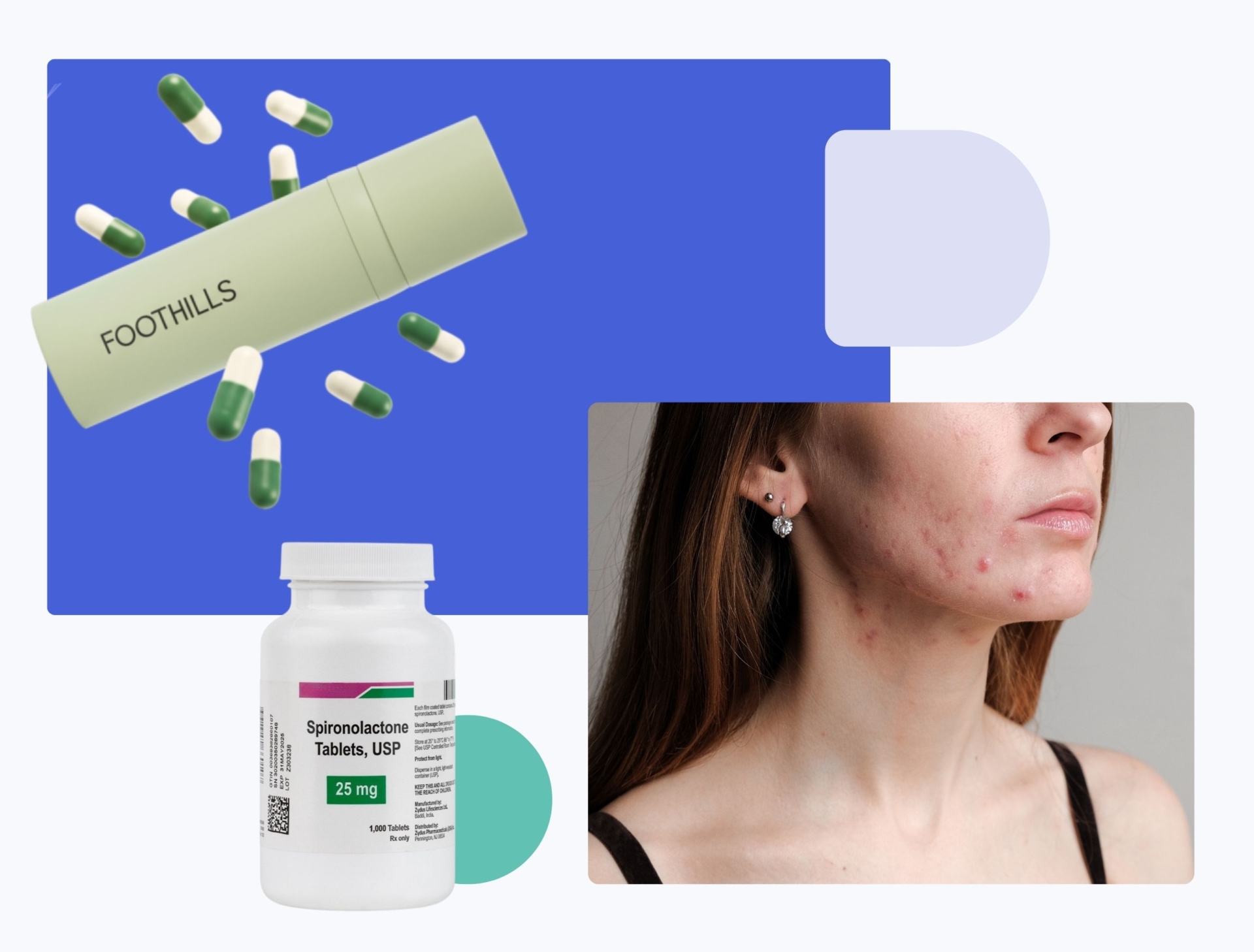 Does spironolactone cause hair loss?