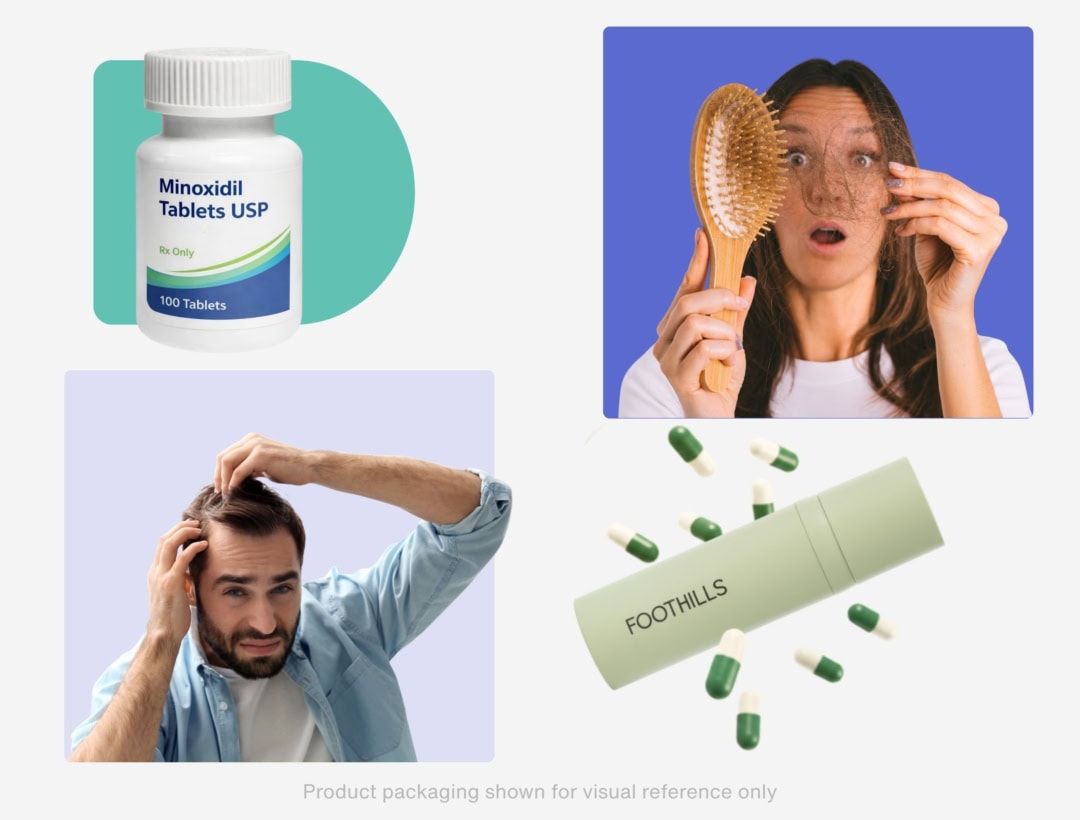 Is minoxidil over the counter (OTC)?